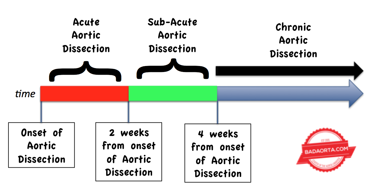The Test of Time: Acute versus Chronic Aortic Dissections