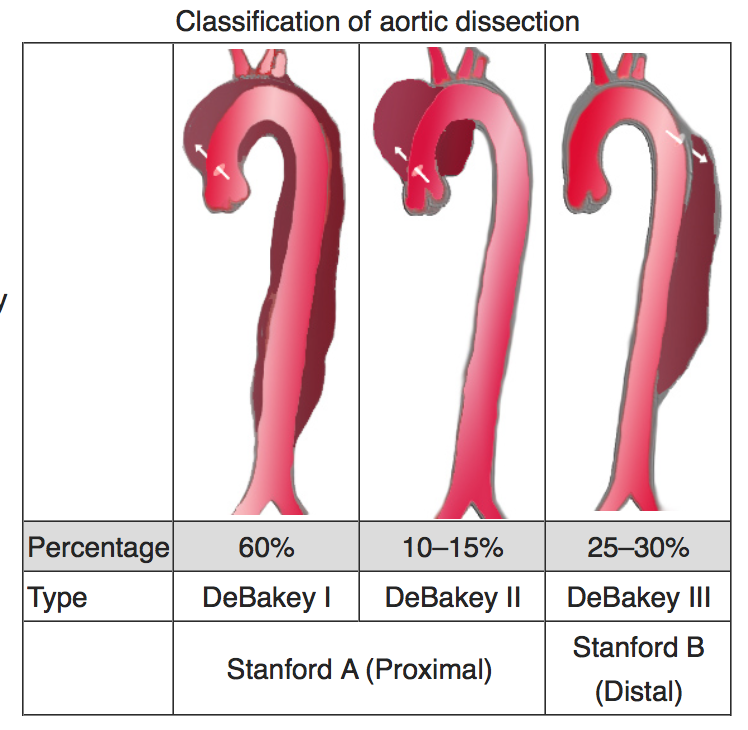 The Test of Time: Acute versus Chronic Aortic Dissections